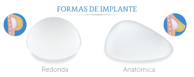 Médica Sur: Cirugía de senos, mamoplastia