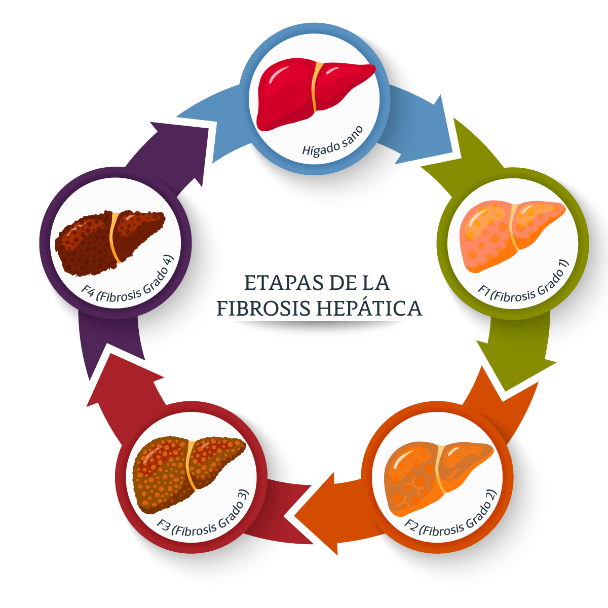 Médica Sur: Fibroscan®