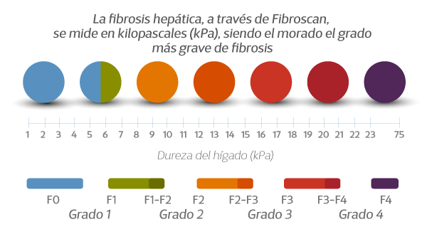Médica Sur: Fibroscan®